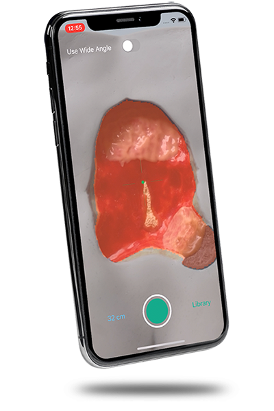 CARES4WOUNDS Wound Management System | Tetusyu Healthcare